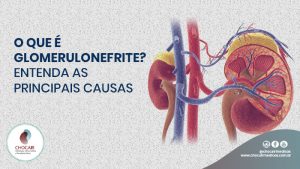 O que é glomerulonefrite? Entenda as principais causas - Chocair Médicos