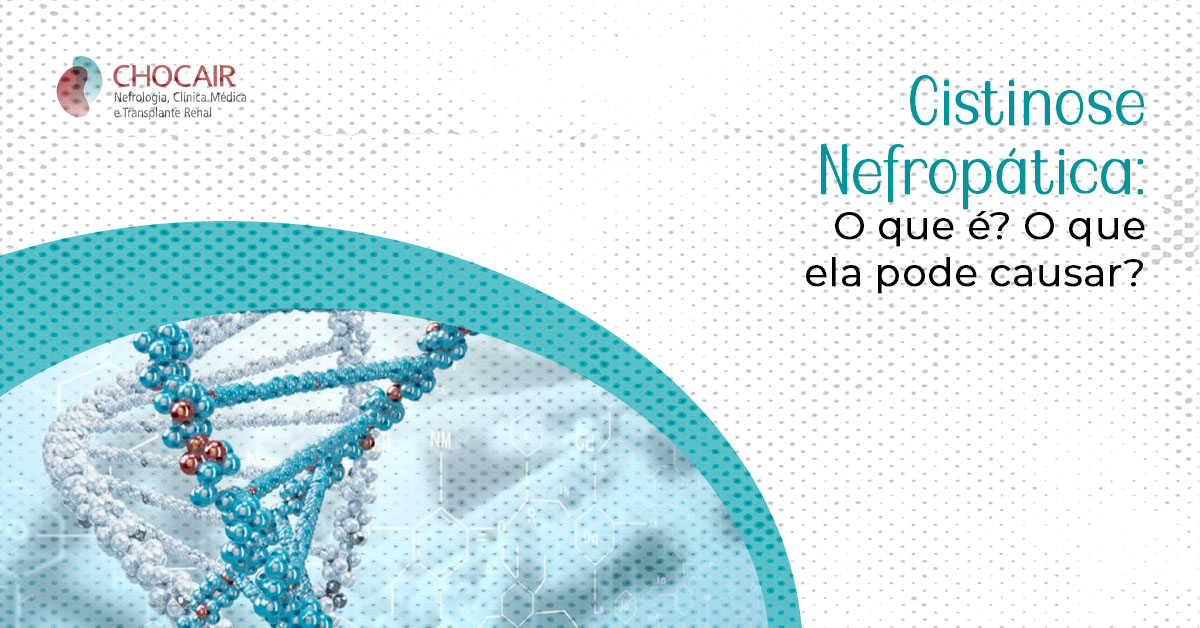Cistinose Nefropática: O que é? O que ela pode causar? – Chocair Médicos Cistinose Nefropática: O que é? O que ela pode causar? – Chocair Médicos